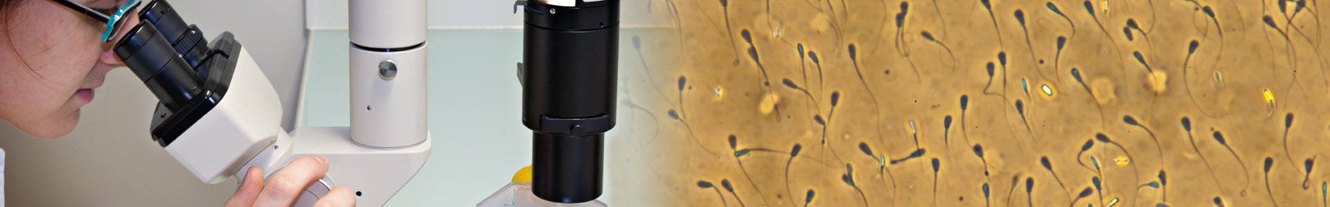 Services | GLYcoDiag