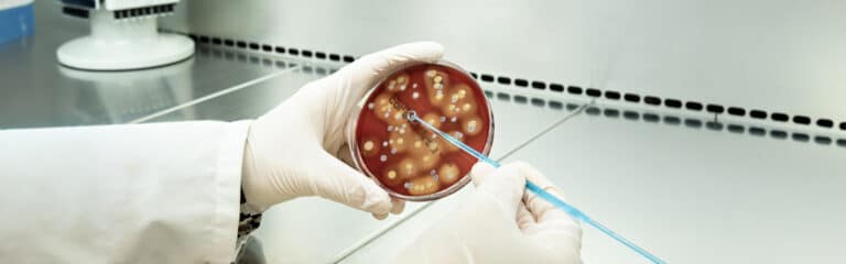 GLYcoDiag Light on : Skin microbiota studies